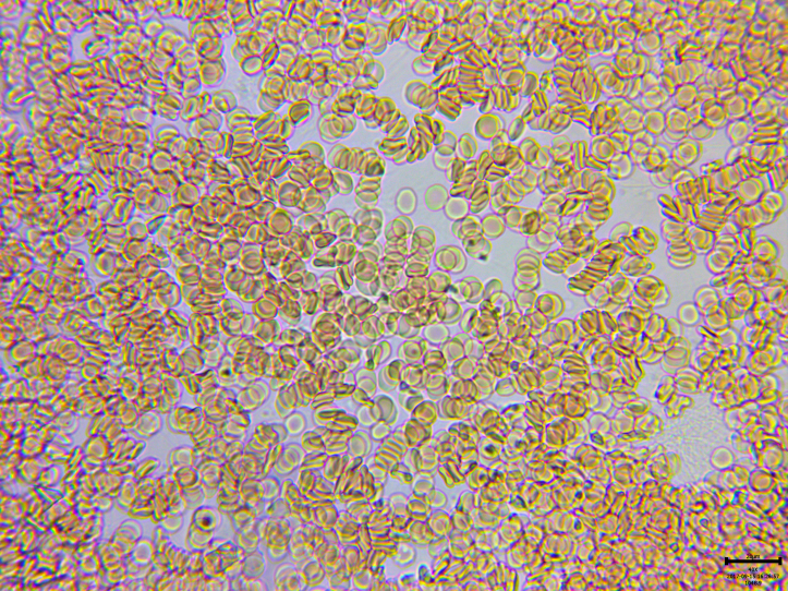 Review of the OMAX 40X-2500X Digital LED Trinocular Microscope with 5MP ...